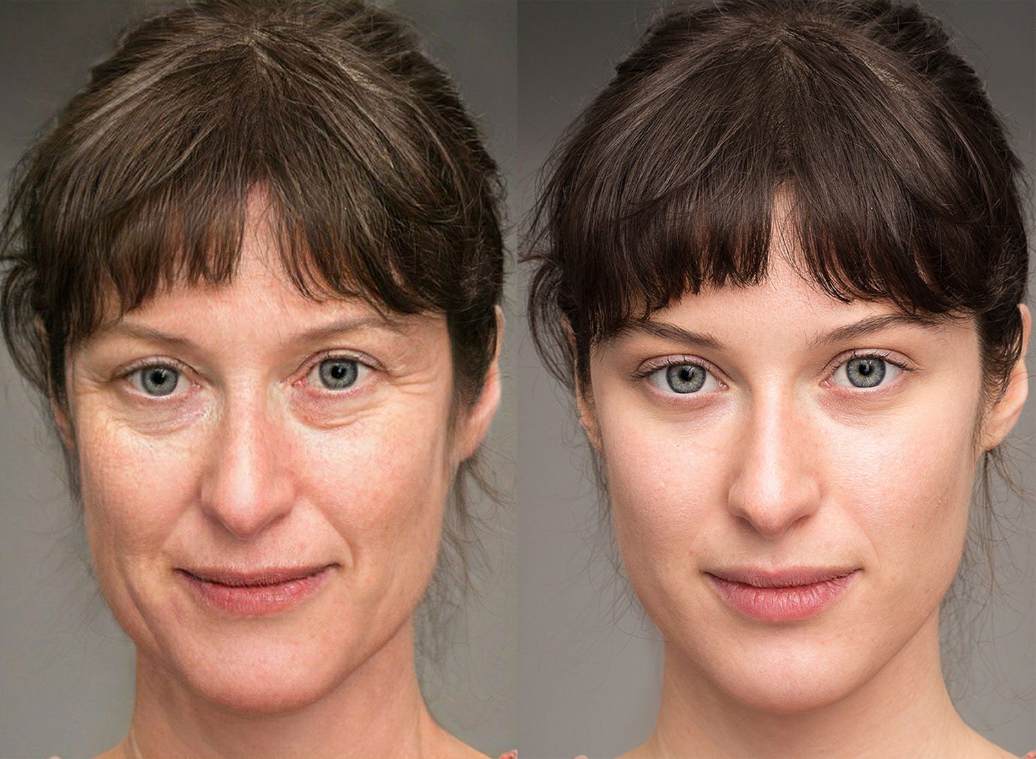 IV Hydration Therapy - Innovation Health